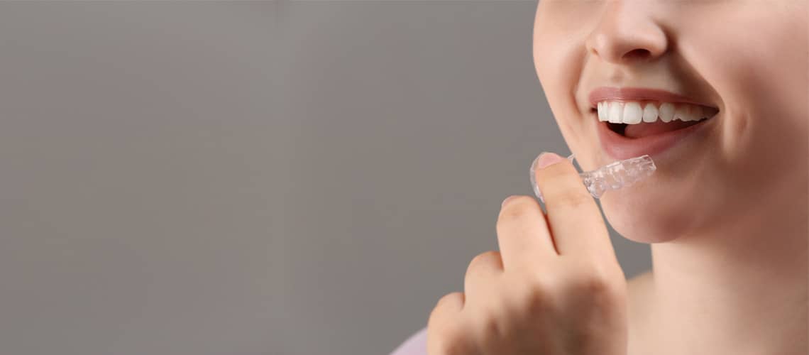 How To Use And Wear Your Bite plate | Bite plate Instructions | Serving ...