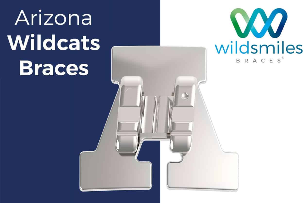 WildSmiles Unique Braces | Mix and Match Bracket Shapes | Serving ...