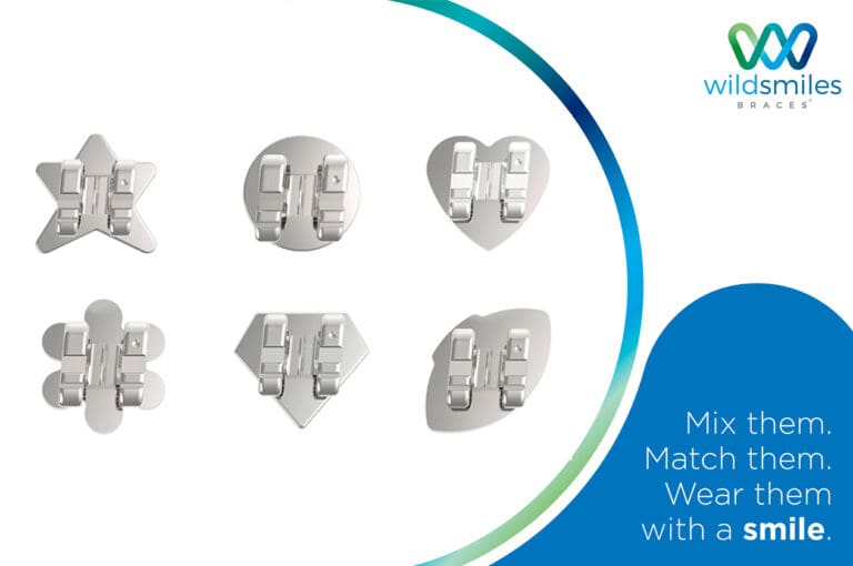 WildSmiles Unique Braces | Mix and Match Bracket Shapes | Serving ...