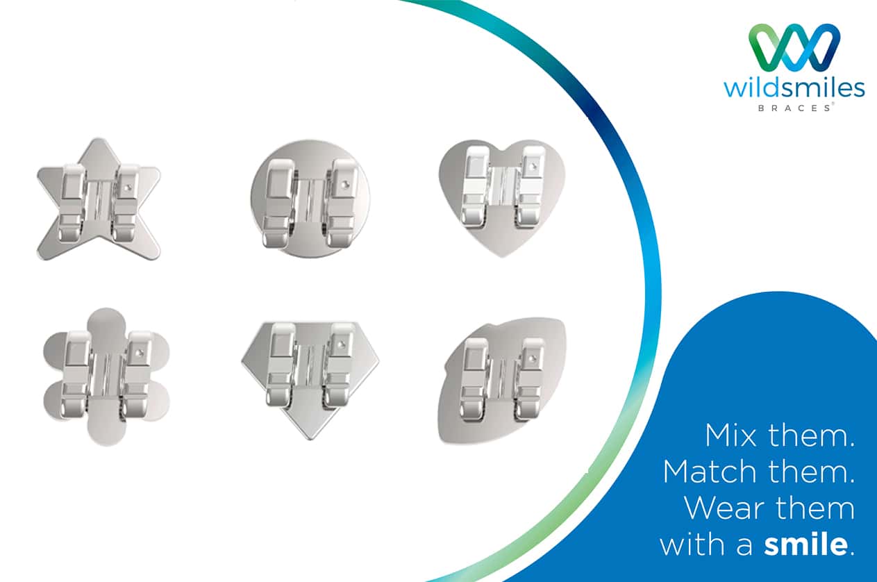 WildSmiles Unique Braces | Mix and Match Bracket Shapes | Serving ...